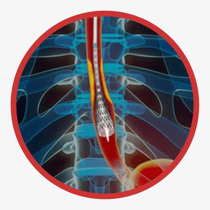 Merit Medical Systems